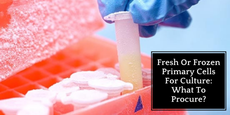 Fresh Or Frozen Primary Cells For Culture: What To Procure? | Kosheeka