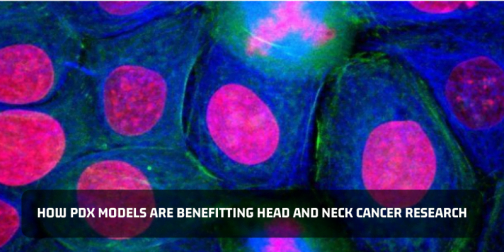 How PDX Models are Benefitting Head and Neck Cancer Research