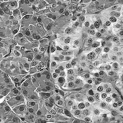 Human Islet Beta Cells - Kosheeka