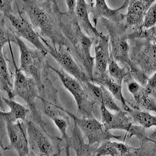 Human Cardiac Fibroblasts - Kosheeka