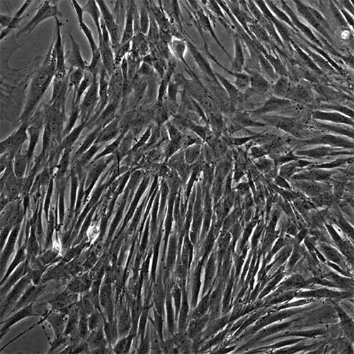 Human Kidney Fibroblasts - Kosheeka