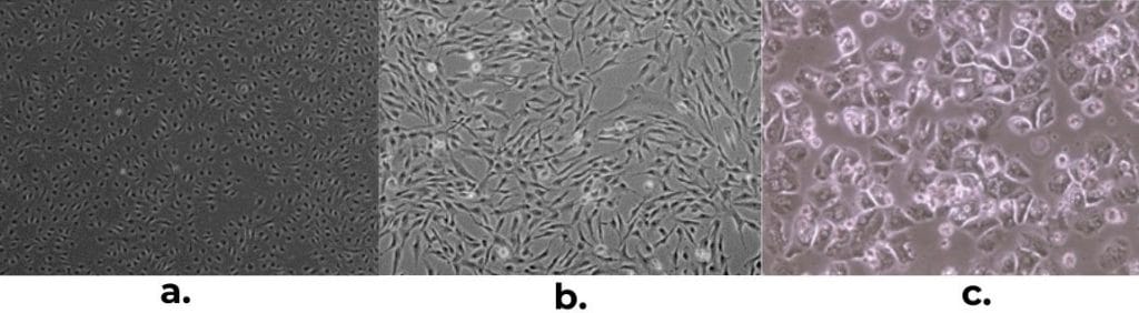 Primary Cell Culture: What, Why, and How?